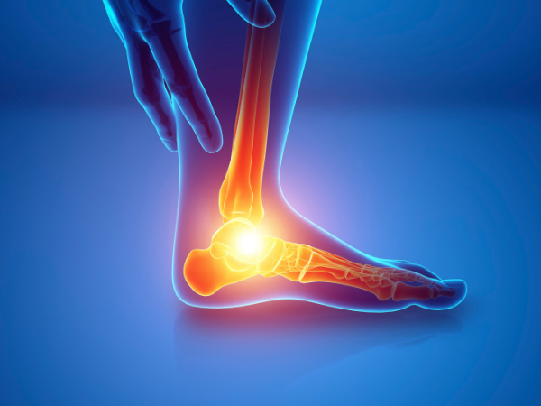 Diabetic Foot Conditions Treated | Ulcers, Gangrene, Charcot — EDFC
